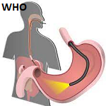 Indications and findings of oesophagogastroduodenoscopy in patients ...