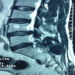 Textiloma mimicking soft tissue tumor: an uncommon complication of ...
