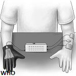Effectiveness of surge faradic stimulation and proprioceptive ...